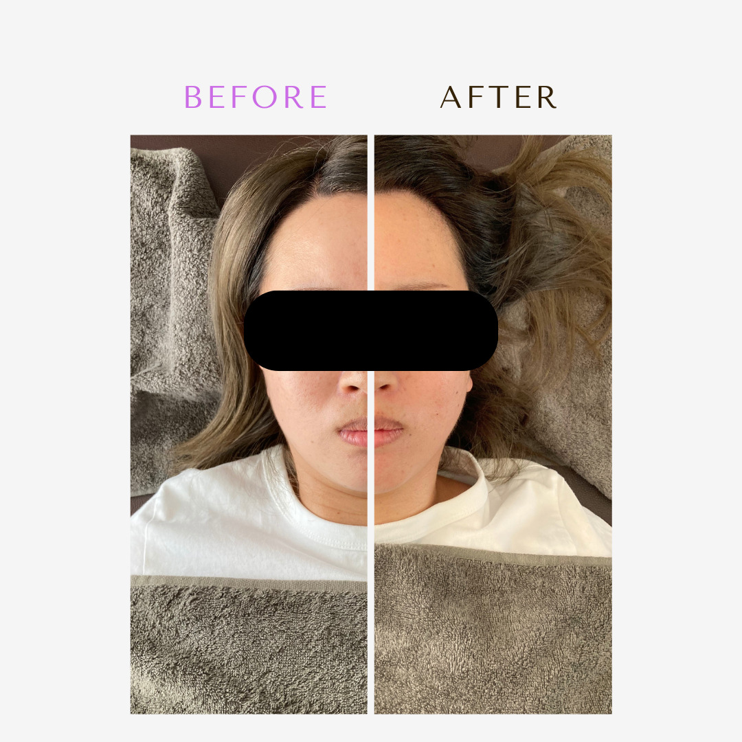 RE:POST body care studio | 「美容」×「医学的知識」の新しい美容整体